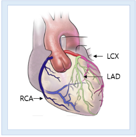 RWMA = regional wall motion abnormality (심장의 국소 벽 이상증) 간단 공부 : 네이버 블로그