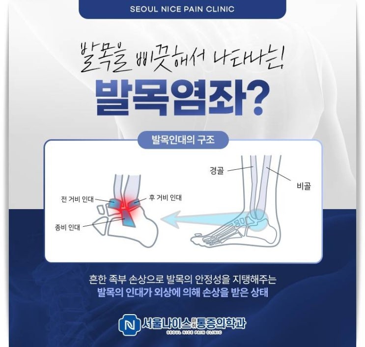 매탄동발목염좌치료 원인 개선이 중요해요 네이버 블로그