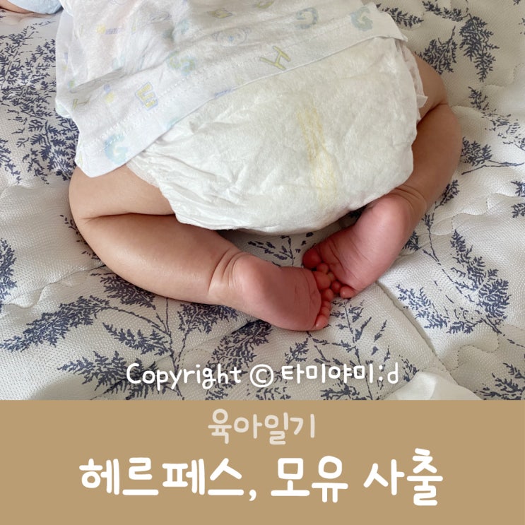 육아일기 헤르페스 모유 사출 이유 모유 수유 다시 시작 네이버 블로그