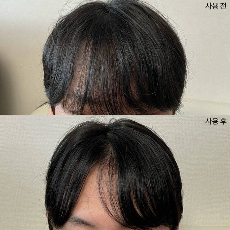 남자 셀프 옆머리 다운펌 약 추천 실패없는 포뷰트 다운크림 후기 주기 방법 네이버 블로그