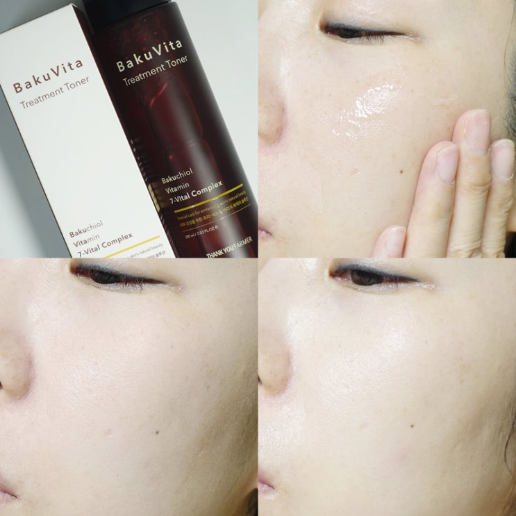 안티에이징엔 주름개선 비건화장품 땡큐파머 바쿠비타 토너로 얼리케어 네이버 블로그