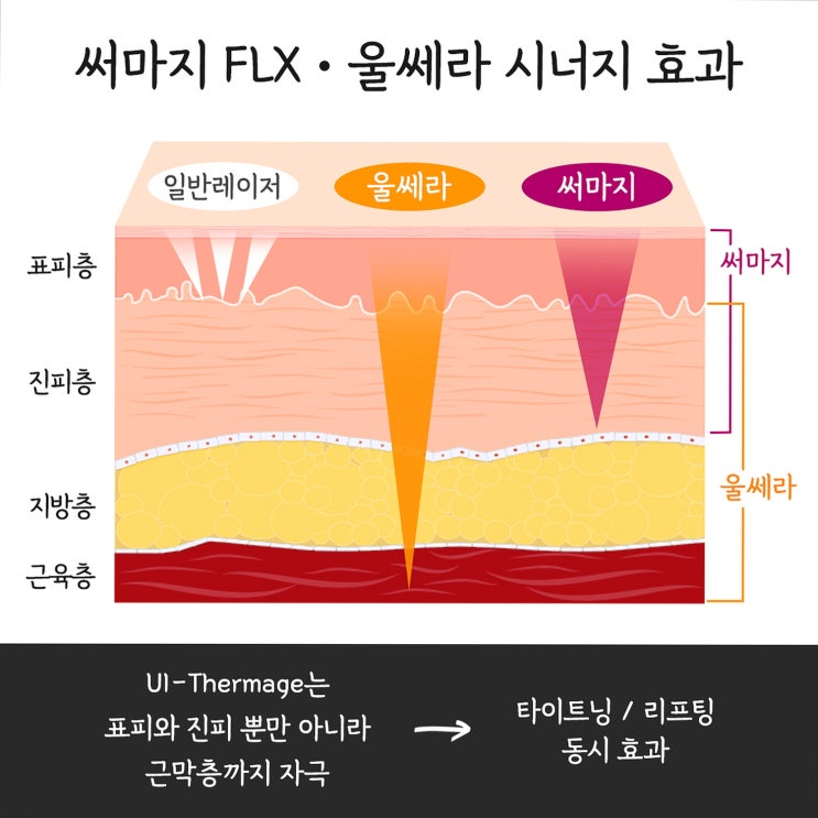 울쎄라 써마지 가격 차이 등에 대해 현직 의료진이 말씀드릴게요 네이버 블로그