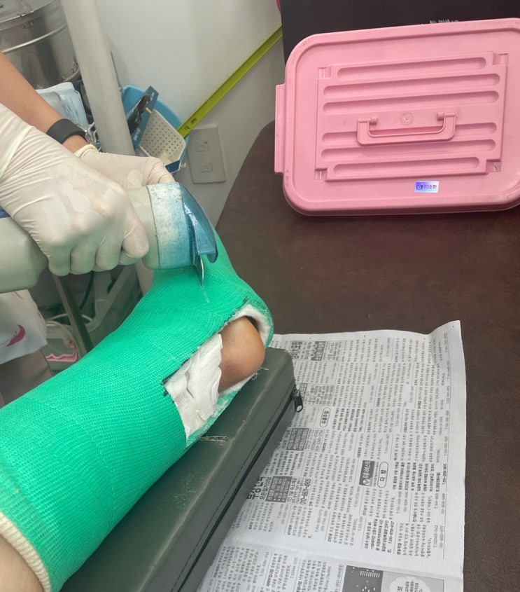 아킬레스건 파열, 수술, 깁스 보조기, 물리치료, 재활치료(보조기 없이 보호대로 회복하기) 2. 퇴원 후 재활 과정 : 네이버 블로그