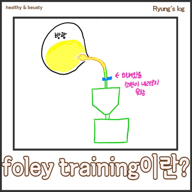 foley training (bladder training) 방광훈련의 목적, 방법에 대해 알려드립니다. : 네이버 블로그