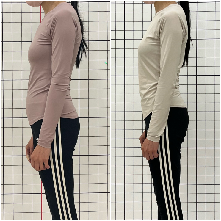 구월동 필라테스 힙필라테스 모래내시장역점 척추측만증 완화 네이버 블로그