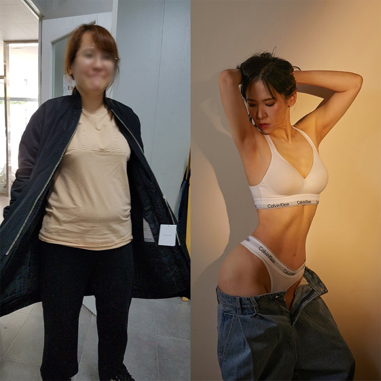 81kg ️49.6kg | 꿈같은 다이어트를 성공하다! 총 31kg 감량 회원님 (고도비만 다이어트) : 네이버 블로그