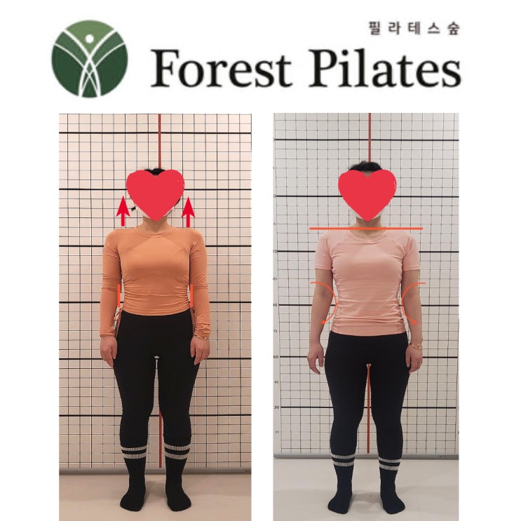 기침가래에 좋은음식 수영구 기구 필라테스부산 필라테스수영구 필라테스수영역 필라테스 수영기구필라테스 수영