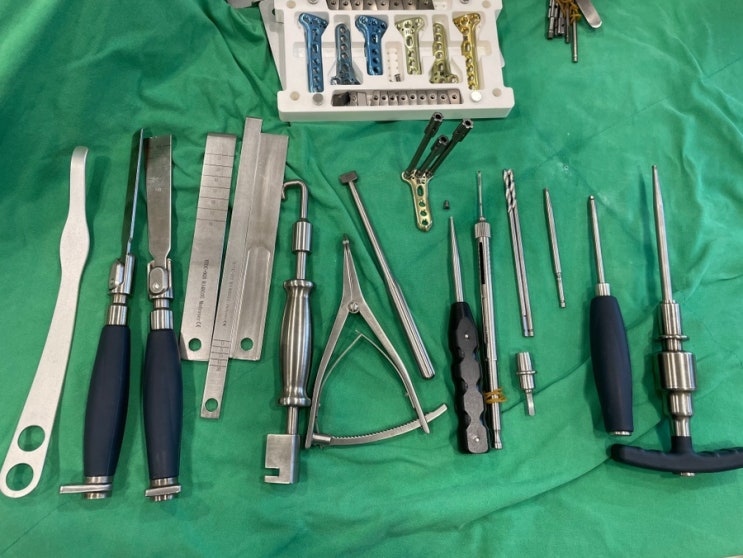 무릎 관절 절골술 (HTO, High Tibia Osteotomy) Open wedge osteotomy : 네이버 블로그