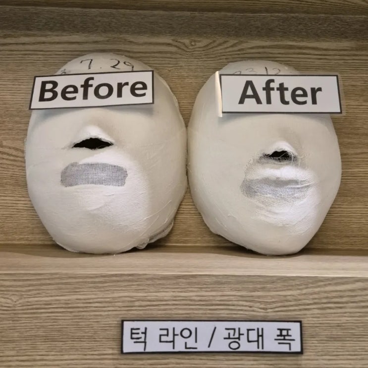 김해피부관리 약손명가 1회 효과 있을까 네이버 블로그