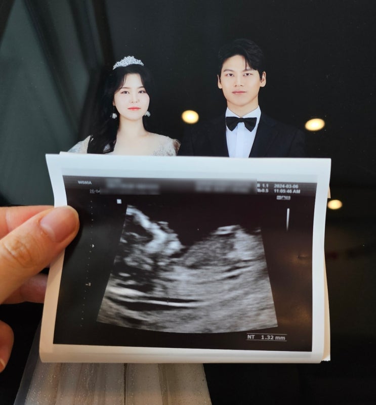 임신일기 임신 12주 1차 기형아 검사 첫 정밀초음파 후기 임산부 갑상선기능저하증 진단 네이버 블로그
