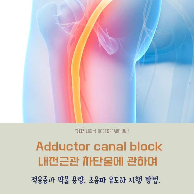 초음파 유도하 Adductor canal block (내전근관 차단술)에 관하여. 해부학 구조, 지배 신경, 약물 사용법은 ...