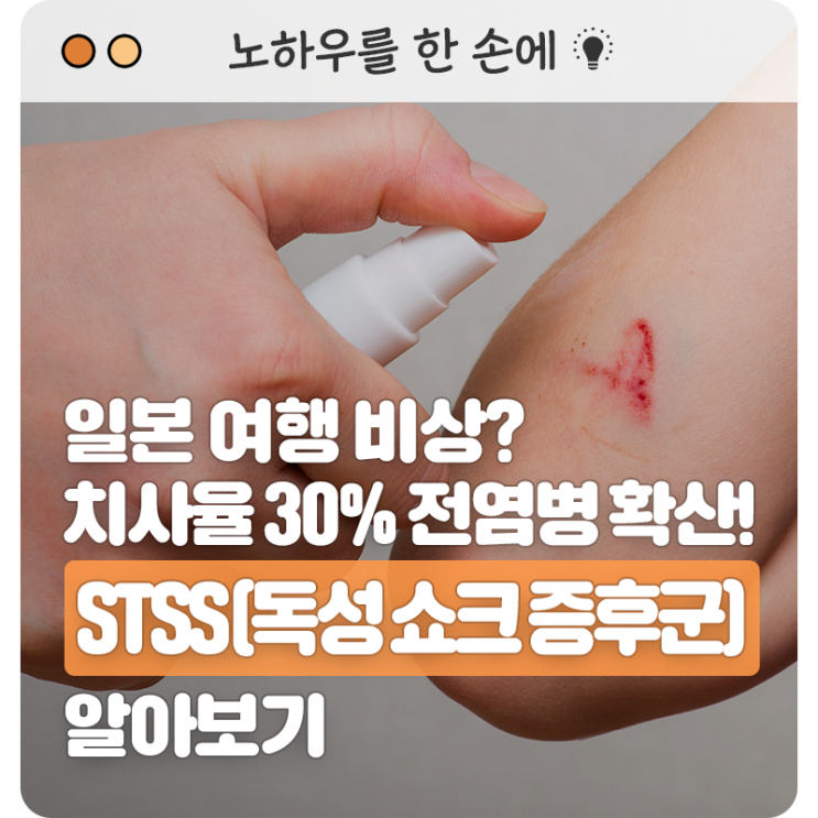 치사율 30% 일본 전염병 감염병 확산! STSS 알아보기 (Feat. 증상 & 예방방법) : 네이버 블로그