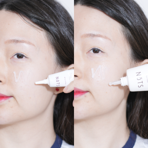 모낭염 연고 재생연고 추천 낫츠 센텔라 트러블 케어 크림 And 연고 같이쓰면 더 좋아 네이버 블로그