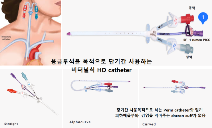응급투석시 필요한 비터널식 투석용 카테터(HD catheter insertion) : 네이버 블로그