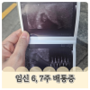 임신 6주 7주 배 통증 임신 극 초기 임산부 아랫배 통증으로 병원 다녀왔어요 네이버 블로그