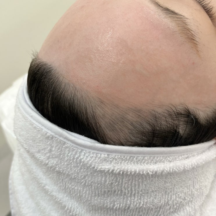 춘천왁싱 춘천헤어라인왁싱 춘천웨딩관리 깔끔한 헤어라인왁싱으로 중요한 일정 준비해보세요 네이버 블로그
