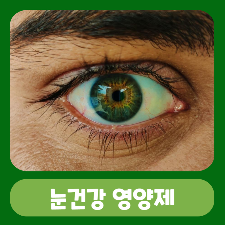 눈건강 영양제 추천 베타카로틴 풍부한 과일 채소 네이버 블로그