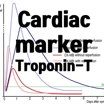 Troponin-T (트로포닌-T)의 검사목적과 이유에 대해서 알아봐요~ : 네이버 블로그