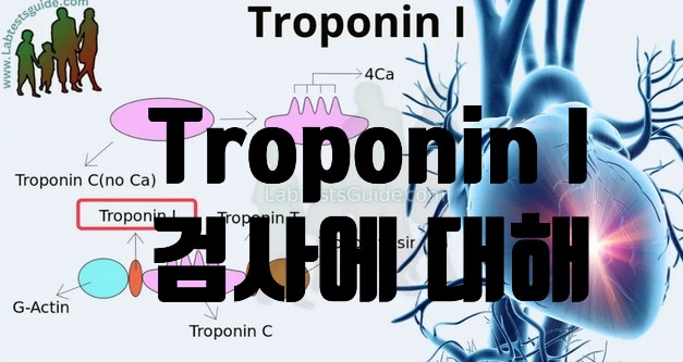 Troponin I 검사의 이유와 목적에 대해서 알아봐요~ : 네이버 블로그