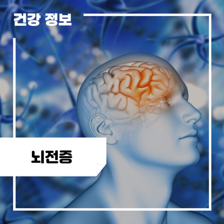 뇌전증 전조 증상 및 원인 치료 완치 유무 약물 발작 시 응급처치 간질 소아 뇌혈관질환 네이버 블로그