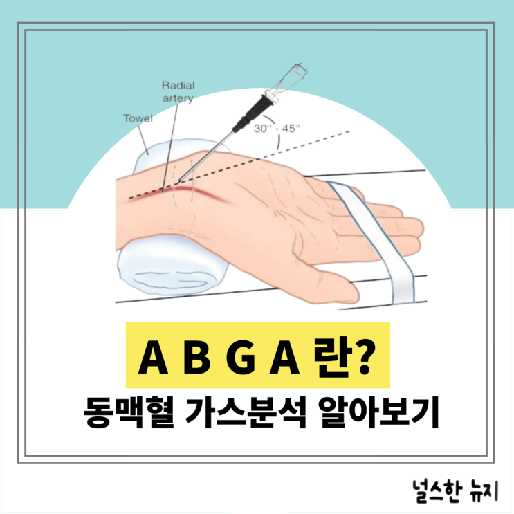 ABGA(동맥혈 가스분석)란? : 네이버 블로그