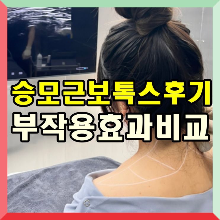 강남 승모근 보톡스 전후 후기 3회차 부작용 효과 비교 네이버 블로그