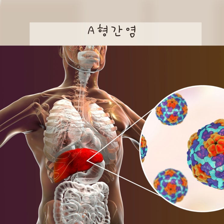 A형간염 원인 초기 증상 전염 격리 치료 백신 예방접종 가격 간격 항체 주의할점 네이버 블로그