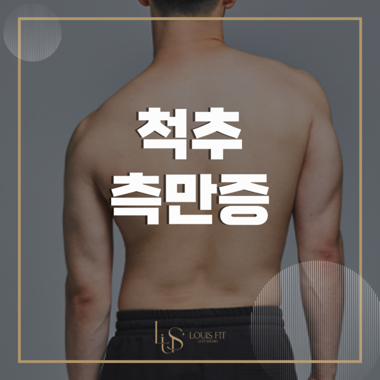 미사필라테스 척추측만증 정말 필라테스로 교정이 되나요 네이버 블로그
