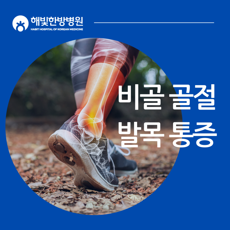 비골 골절로 인한 발목 통증 붓기ㅣ 체외충격파 치료 과정을 공개합니다 전주 해빛 한방병원 네이버 블로그