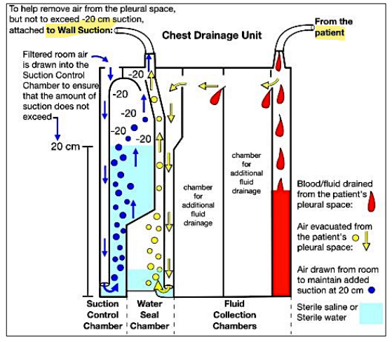 NCLEX basic #5 Chest tube, Congenital Heart Defect : 네이버 블로그