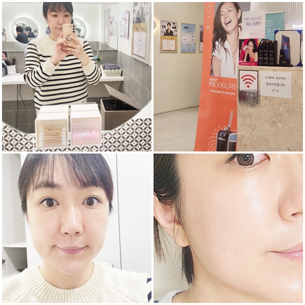 기미잡티 피코슈어 레이저 비타민관리 분당 서현역 피부과 받고온 후기 네이버 블로그