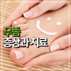 손톱 발톱 발바닥 무좀 증상과 치료가려움 약과 연고 네이버 블로그