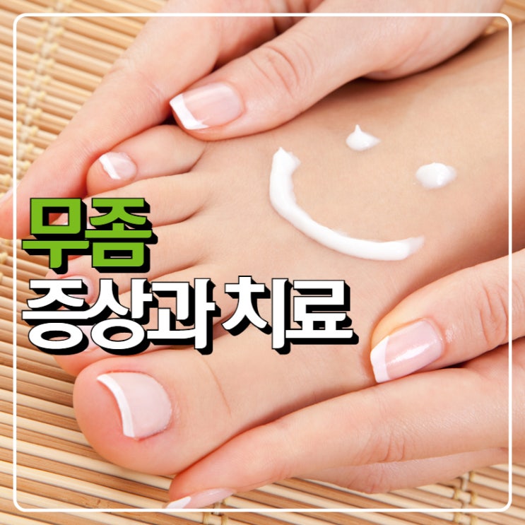 손톱 발톱 발바닥 무좀 증상과 치료가려움 약과 연고 네이버 블로그