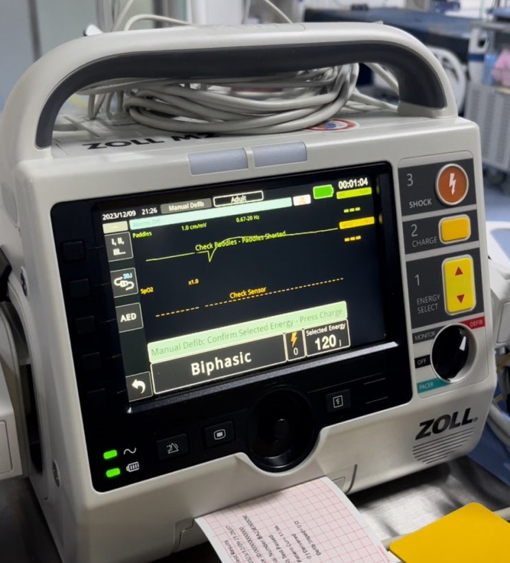 Cardioversion / Defibrillation 차이점 : shock, 제세동기 적응증, CPR rhythm : 네이버 블로그