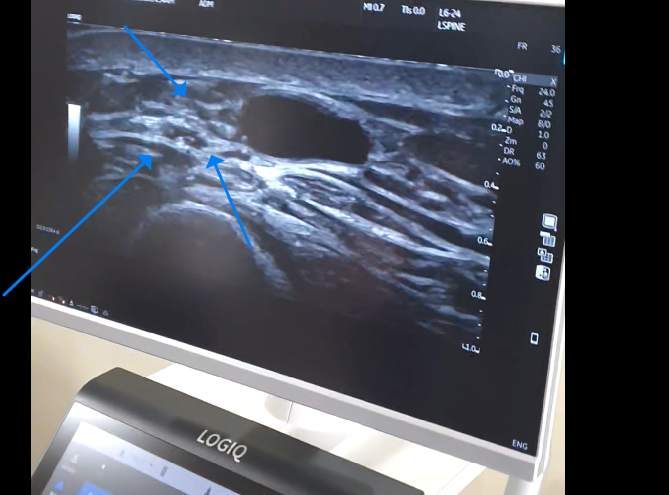 GE 하이엔드 초음파 Totus E10 비교 : 네이버 블로그
