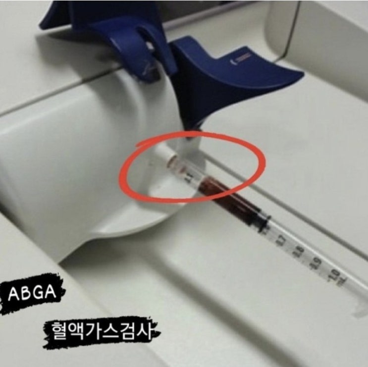 혈액가스검사 ABGA 정상 수치와 동맥혈가스검사의 해석 : 네이버 블로그