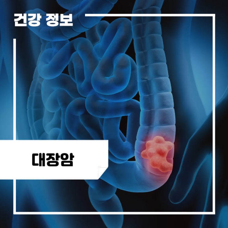 대장암 초기증상 및 전조 징후 발생 원인 검사 수술 혈변 색깔 네이버 블로그