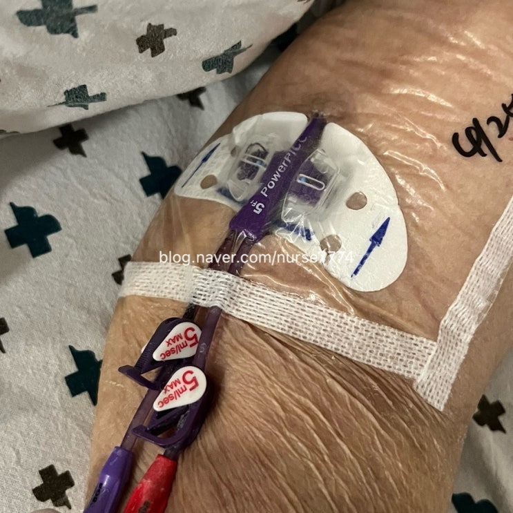 PICC 의학용어 헤파린 드레싱 방법 : 네이버 블로그