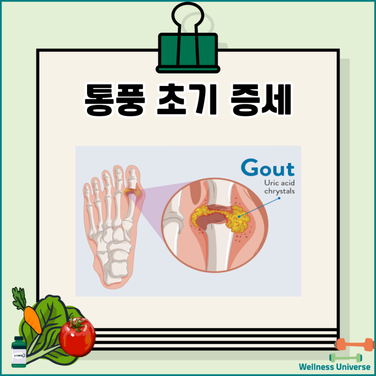 통풍 초기 증세 원인 파악해서 사전 예방해요 네이버 블로그