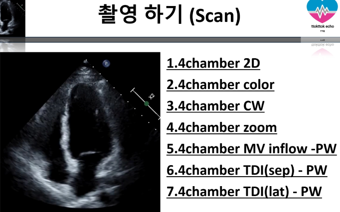 Echo Apical 4CH view 7개, Apical 2CH view 3개 : 네이버 블로그