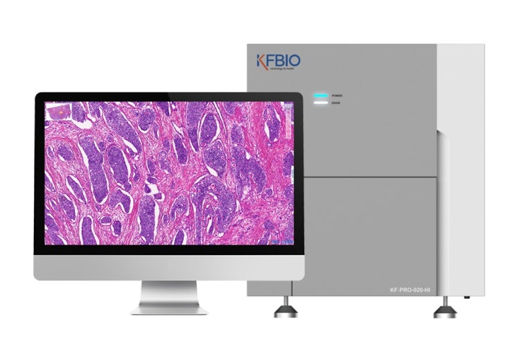현미경 슬라이드 스캐너 KFBIO "KF-PRO-020" Slide Scanner : 네이버 블로그