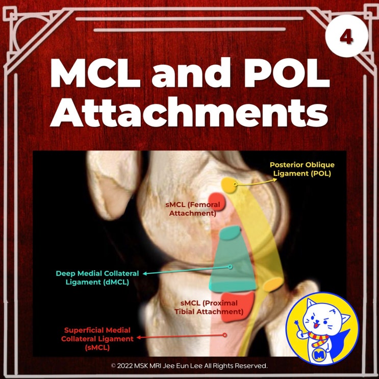 (Fig 3-A.04) MCL(medial collateral ligament) and POL(Posterior oblique ...