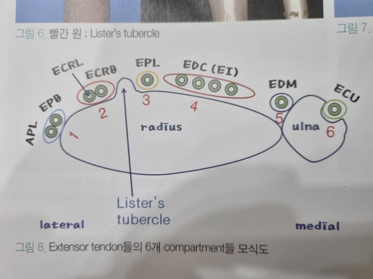 손목 건초염(드퀘르벵병, De Quervain disease) : 네이버 블로그