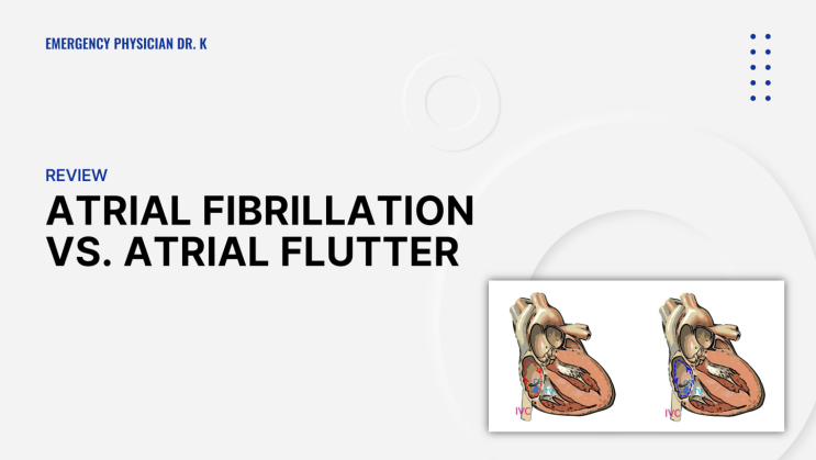 A) Atrial fibrillation vs. Atrial flutter - 무엇일까요? : 네이버 블로그