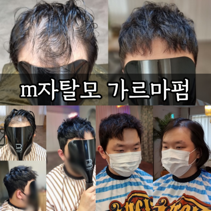 남자 탈모 펌 30대 탈모 20대m자탈모 가르마펌 M자머리 엠자탈모 M탈모펌 M자탈모헤어스타일 엠자이마커버 인천탈모펌