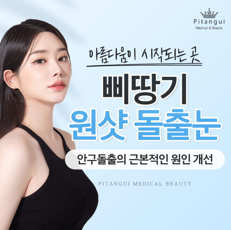 안구돌출수술, 부담스러운 인상과 안병증을 동시에 개선하고 싶다면 : 네이버 블로그