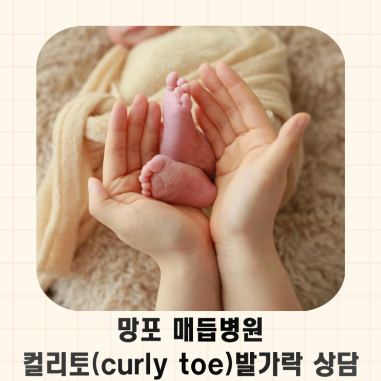망포 매듭병원 유아 컬리토(curly toe; 휜발가락) 발가락 상담 : 네이버 블로그