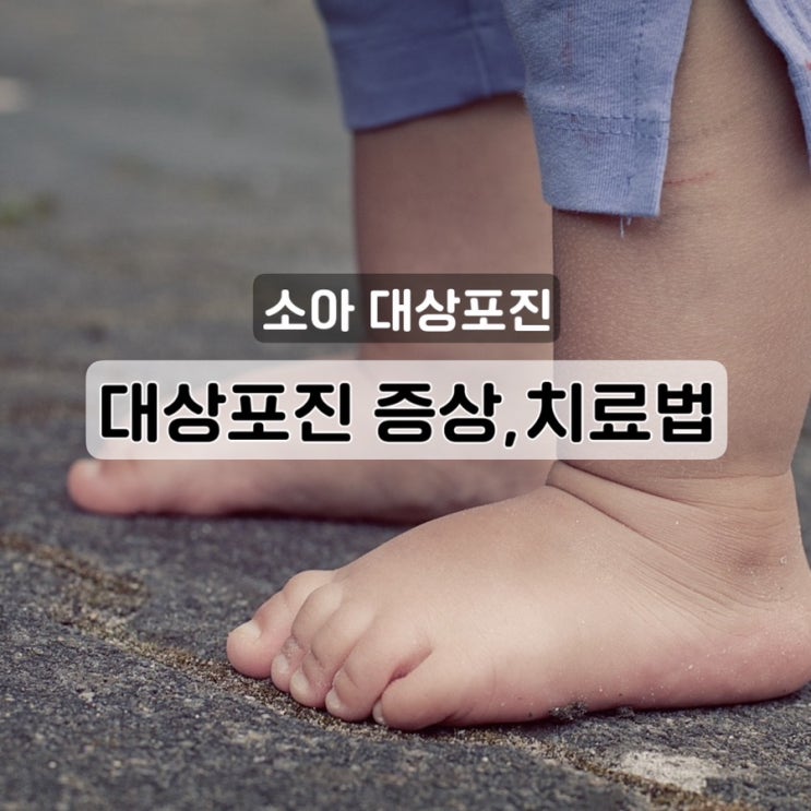우리 아이가 대상포진대상포진 증상아기 대상포진 골든타임 네이버 블로그