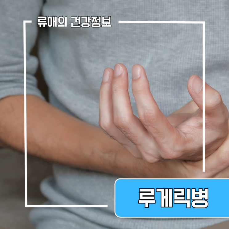 루게릭병 초기증상 및 원인 치료 루게릭병 수명 완치 확률 네이버 블로그