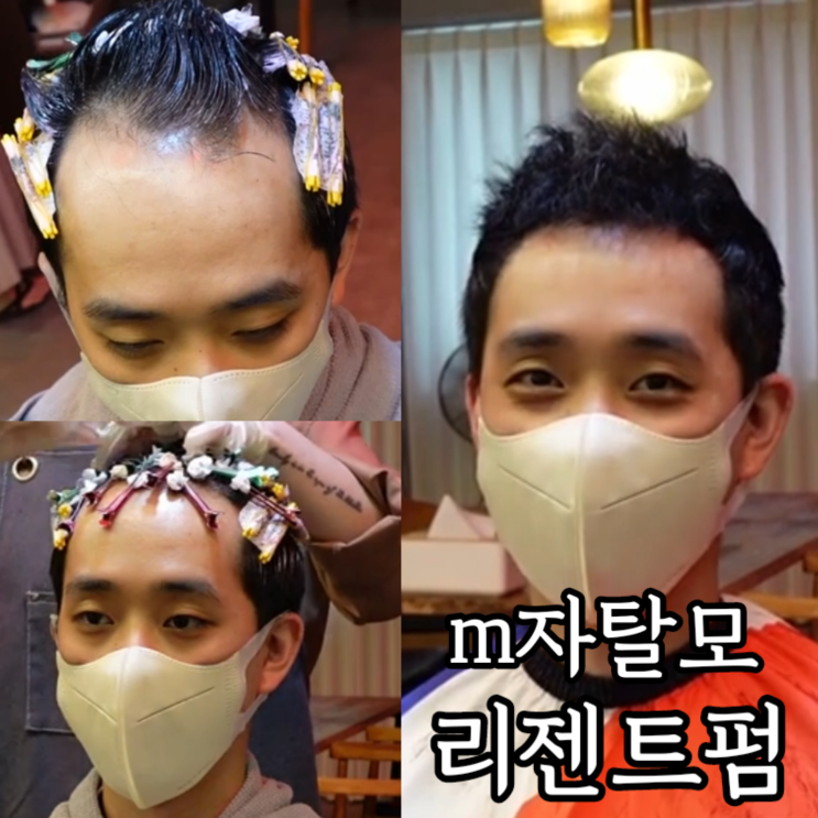 엠자탈모펌 M탈모파마 엠자이마커버 M자탈모헤어스타일 M자 이마 커버 남자머리추천 리젠트 크롭컷 상봉동에서 오셨어요 네이버 블로그